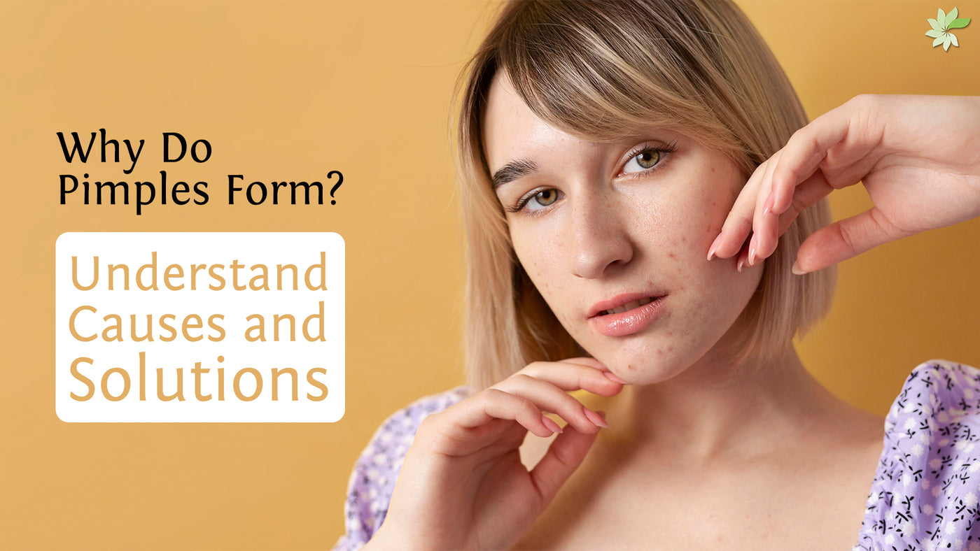 Why Do Pimples Form? Understand Causes and Solutions – minaturewellness